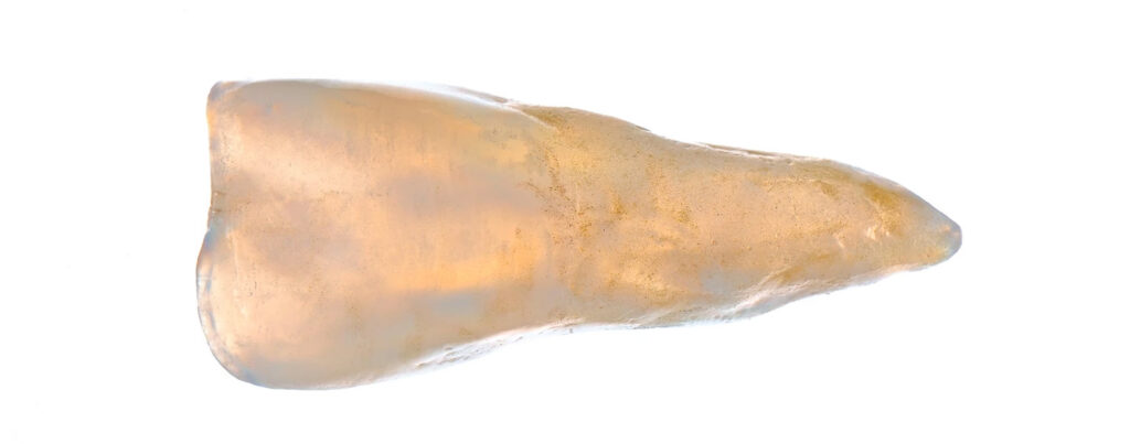 Celtra Press - Illuminating a New Generation of Dental Ceramics ...